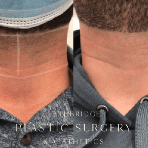 Home - Lethbridge Plastic Surgery & Aesthetics | Dr. Matthew Secretan