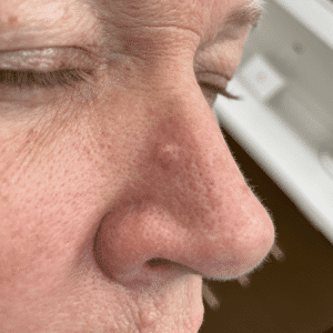 Lethbridge Plastic Surgery & Aesthetics